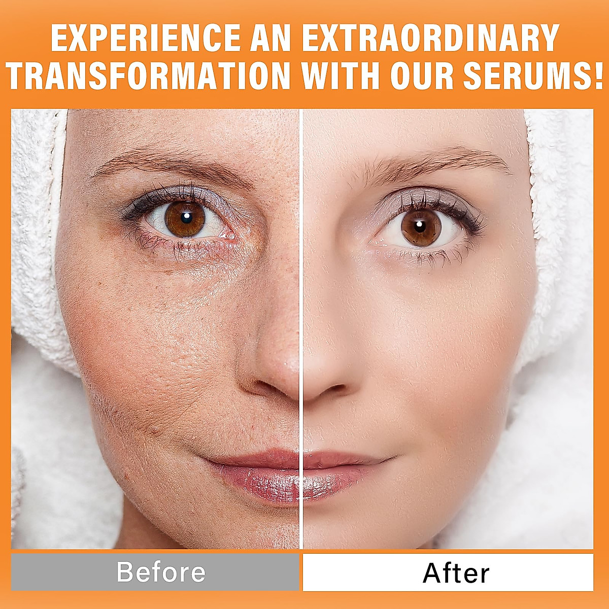 Vitamin C Serum for Face, Gentle Anti-Aging Facial Treatment with Hyaluronic Acid -Arouse Skin Energy, Firming & Hydrating, Improve Skin Luster