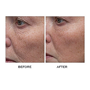 ELEMIS Peptide4 Thousand Flower Treatment; Revitalizing Face Treatment, 2.5 Fl Oz