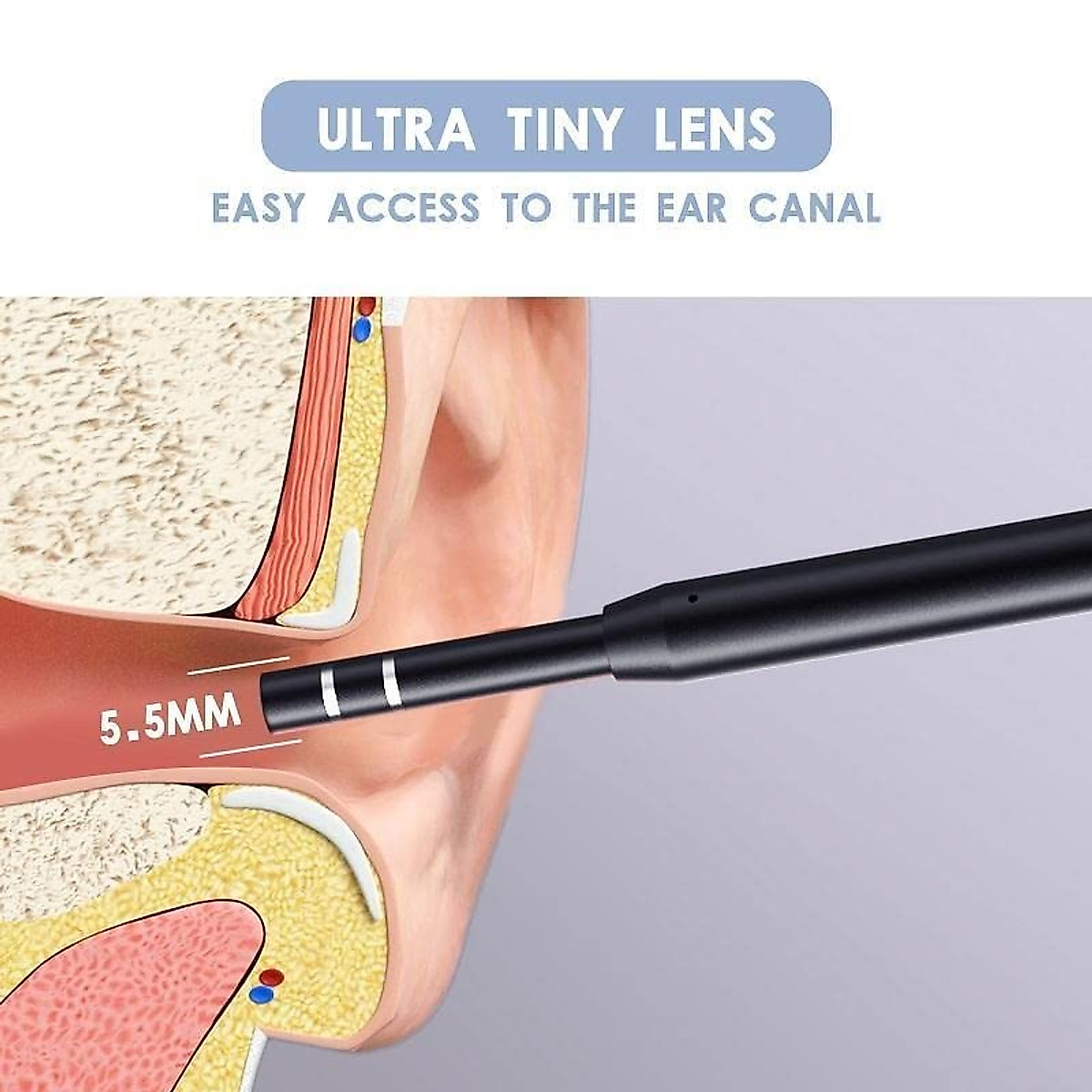Ear Wax Removal Personal Care USB Ear Camera,Nose Camera, Throat Camera, Skin Camera for Kids, Adults, Pet,Compatible with Androids & Windows & Macs,NOT for iPhone/iPad