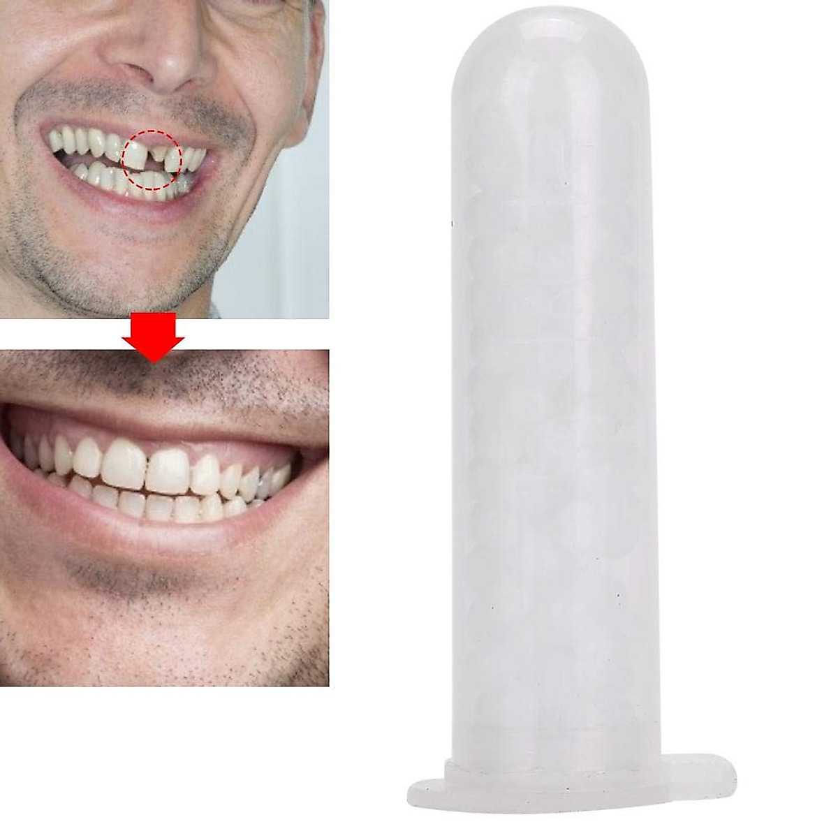 Temporary Broken Teeth Repair Kit, Moldable False Teeth for Snap On Instantly