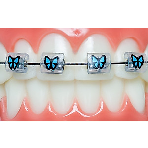 Snapcaps Braces Bumper Cover, Orthodontic Bracket Wax Substitute, Alternative Snap-on Braces Guard Braces Accessories 10 pack (Butterfly)