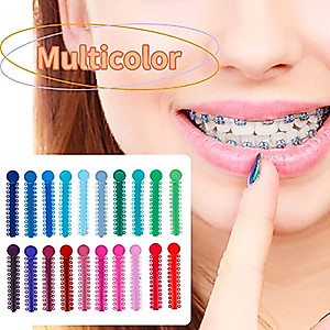 1040 Pcs Multicolored Braces Rubber Bands Orthodontic Ligature Ties O-Rings Elastic Bands for Braces (Color)