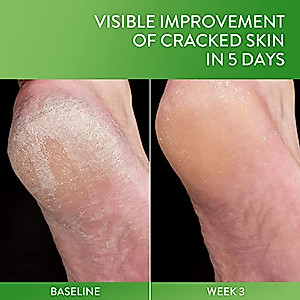 CETAPHIL Cracked Skin Repair Balm, 3 oz, For Very Rough & Cracked, Sensitive Skin, Protects, Soothes & Restores Deeper Cracks, Hypoallergenic, Fragrance Free, (Packaging May Vary)