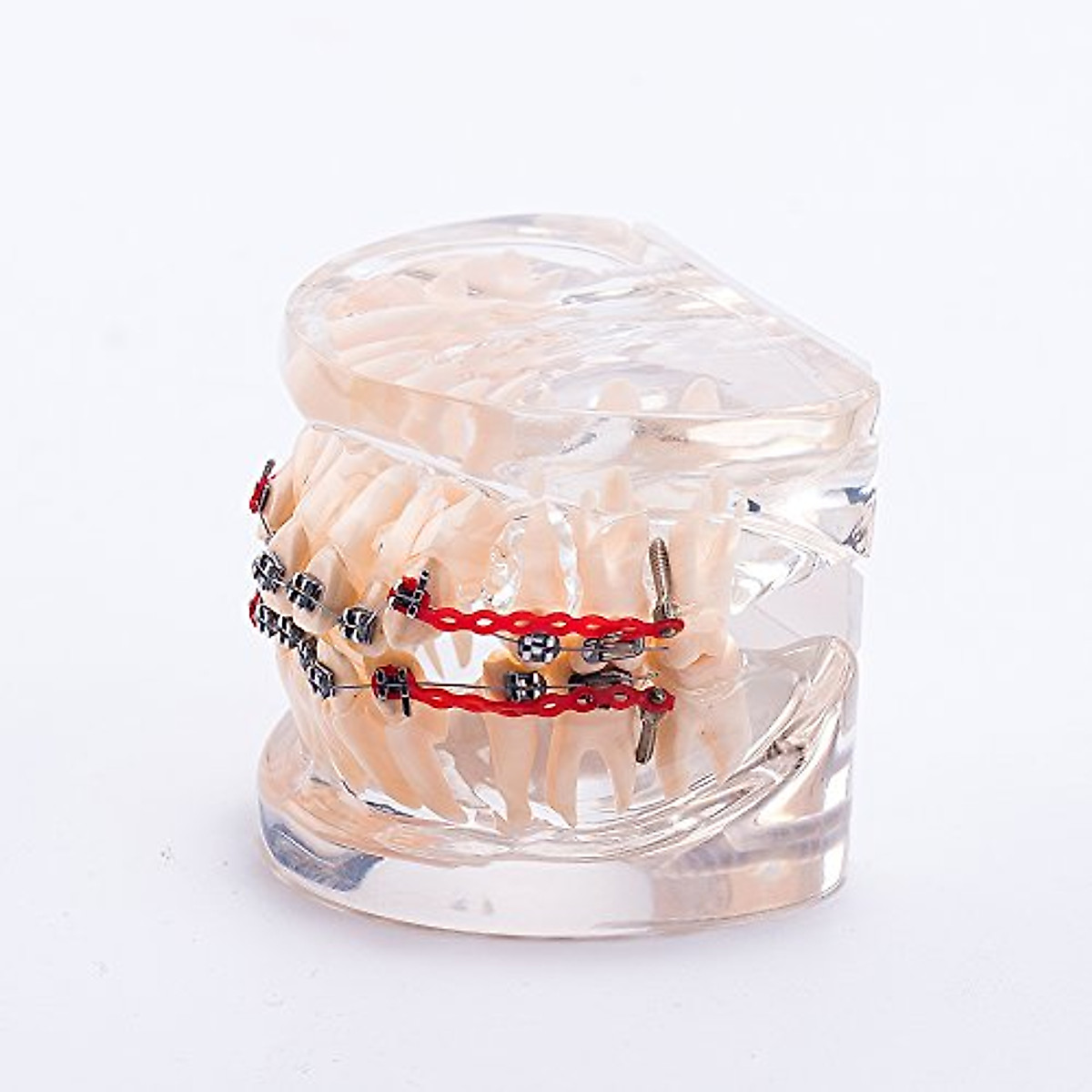 Easyinsmile Dental Orthodontic Treatment Model Teeth/Tooth/Denture Model with Braces for Dentist Studying Researching and Patient Education (Metal Bracket)