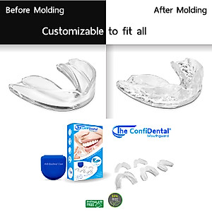 The ConfiDental - Pack of 5 Moldable Mouth Guard for Teeth Grinding Clenching Bruxism, Sport Athletic, Whitening Tray, Including 3 Regular and 2 Heavy Duty Guard (3 (lll) Regular 2 (II) Heavy Duty)