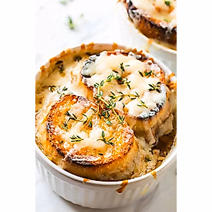 TomorrowSeeds - 3 Colors Mix Onion Sets (Starter Bulbs) Yellow, Red, White Sweet Onions Set for Planting Gardening Noon Day Neutral Vegetable Seed for 2023 - 1/2 Pound