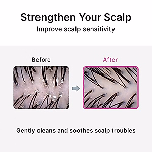 simplyO Refreshing Scalp Shampoo | Biotin & Panthenol I Dry, Itchy Scalp | Paraben-Free, Sulfate-Free I Green Breeze I 10.1 fl. oz