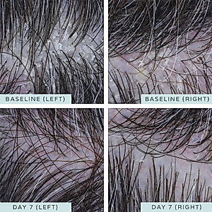 AMELIORATE Clarifying Shampoo 250ml, (12105386)