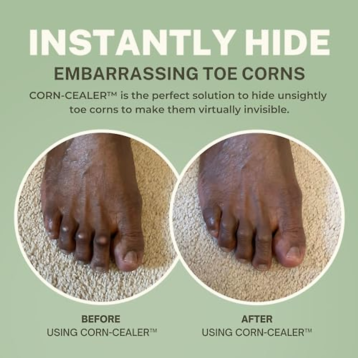 CORN-CEALER | Toe Corn Makeup | Instantly Hide Toe Corns | Concealer For Toe Corns (Shade-NUTMEG)