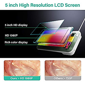 Ear Wax Removal Otoscope,Sinohrd Ear Camera with 5 Inch 1080P HD Screen Ear Scope Otoscopes,3.9mm Light Lens Inspection Endoscope Ear Wax Removal Tool USB Rechargeable Otoscope