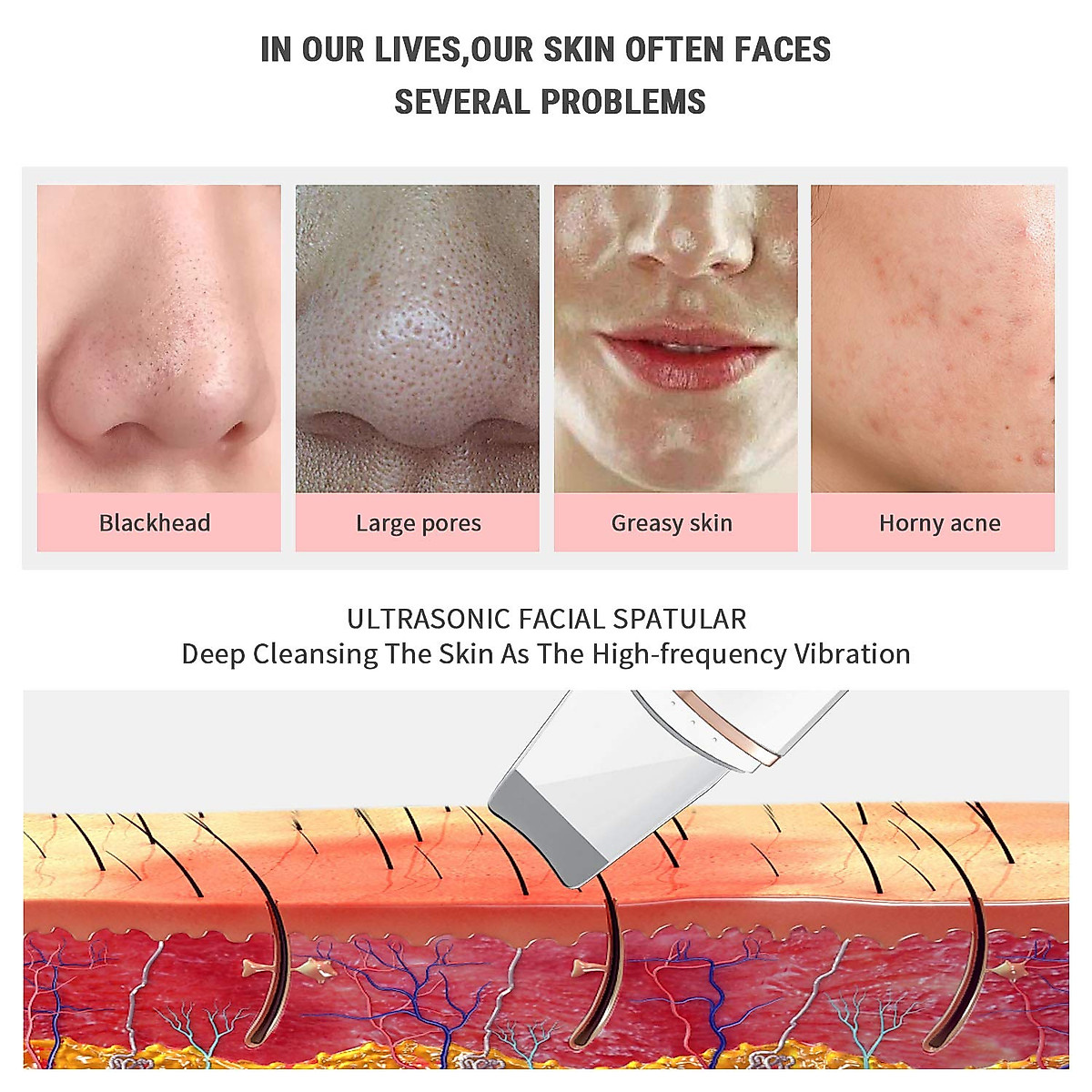 Skin Scrubber, Skin Spatula, Pores Cleanser Exfoliator Blackhead Remover Comedones Extractor for Facial Deep Cleansing with 4 Modes Include 4 Pcs Acne Reml Tool