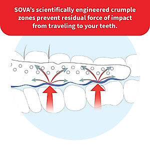 SOVA Max Night Guard - 2.4mm Thin - Custom-Molded Fit - Protects Against Nighttime Teeth Grinding & Clenching - FSA/HSA Eligible - Odor & Taste Free - Remoldable Up to 20 Times - Non Toxic