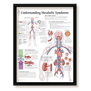 Set of 4 Framed Medical Posters Understanding Diabetes Understanding Cholesterol Understanding Metabolic Syndrome and Understanding Hepatitis 22"x28" Wall Diagrams