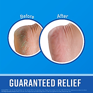 O'Keeffe's for Healthy Feet Foot Cream, Guaranteed Relief for Extremely Dry, Cracked Feet, Instantly Boosts Moisture Levels, 6.4 Ounce Jar, Value Size, (Pack of 1)