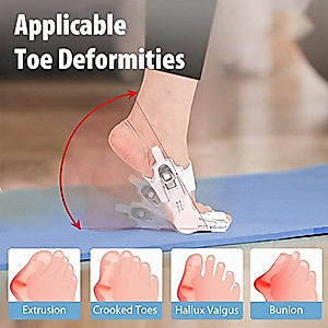 Donnetty Bunion Corrector for Women & Men, Orthopedic Toe Straightener, Adjustable Splint Bunion Pads Day Night Support with Toe Separator for Bunion Relief