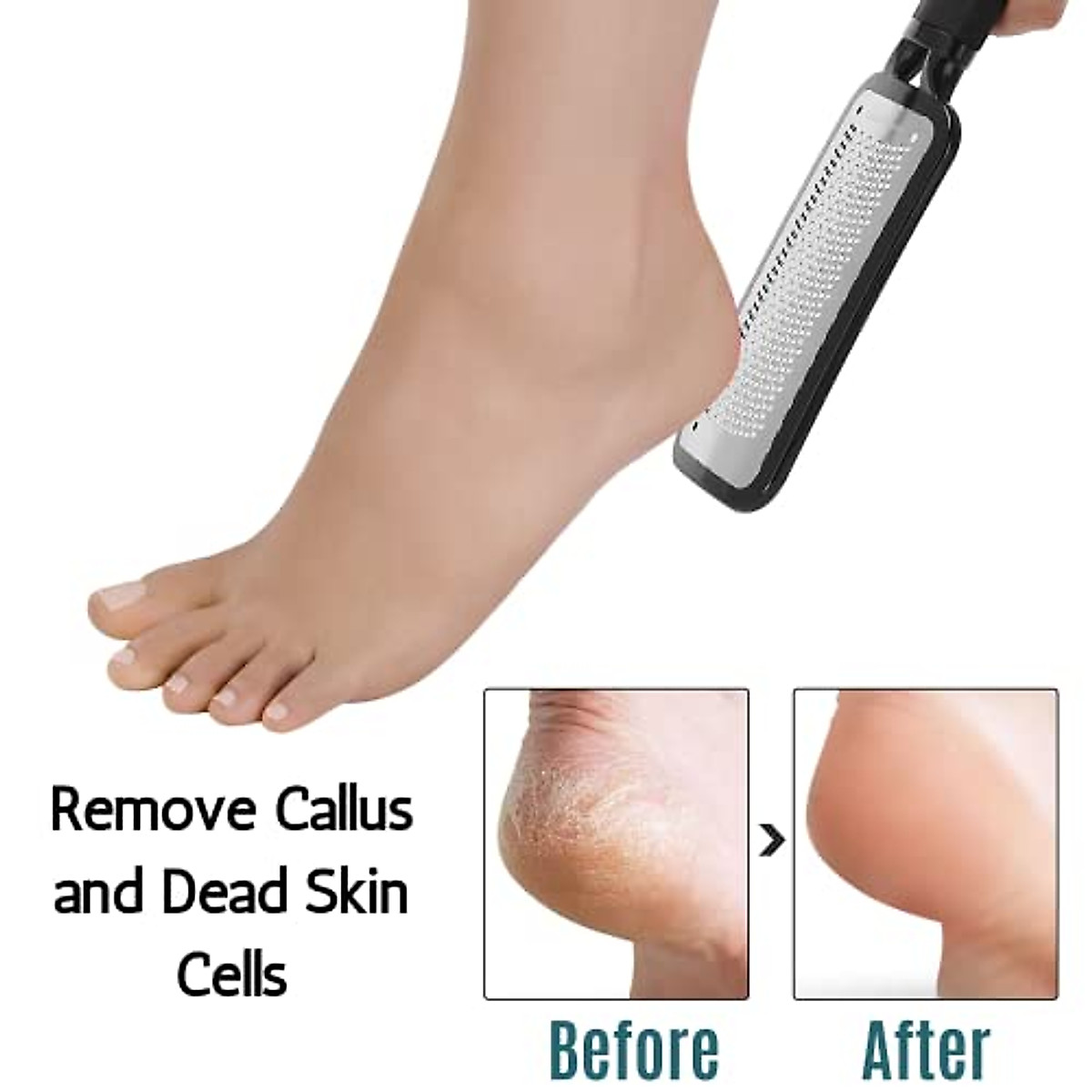 Slick- Foot File Callus Remover, Foot Scrubber, Callus Remover for Feet, Foot File, Foot Scrubber Dead Skin Remover, Foot Callus Remover, Foot Scraper, Dead Skin Remover for Feet, Foot Rasp.