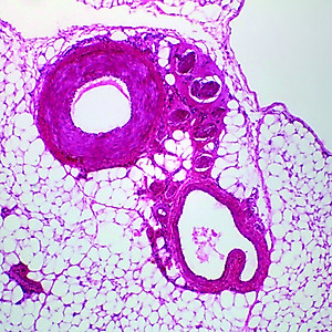 Mammal Artery & Vein C.S. 7 M H&E Microscope Slide