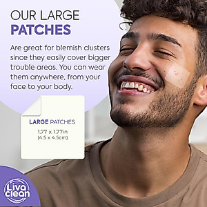 LivaClean 20CT Large Hydrocolloid Acne Patches - For Pore Spots Nose Face Cystic Pimple Zit Patch - Big Pimple Patches Hydrocolloid Bandages Strips Stickers Acne Patch XL Large