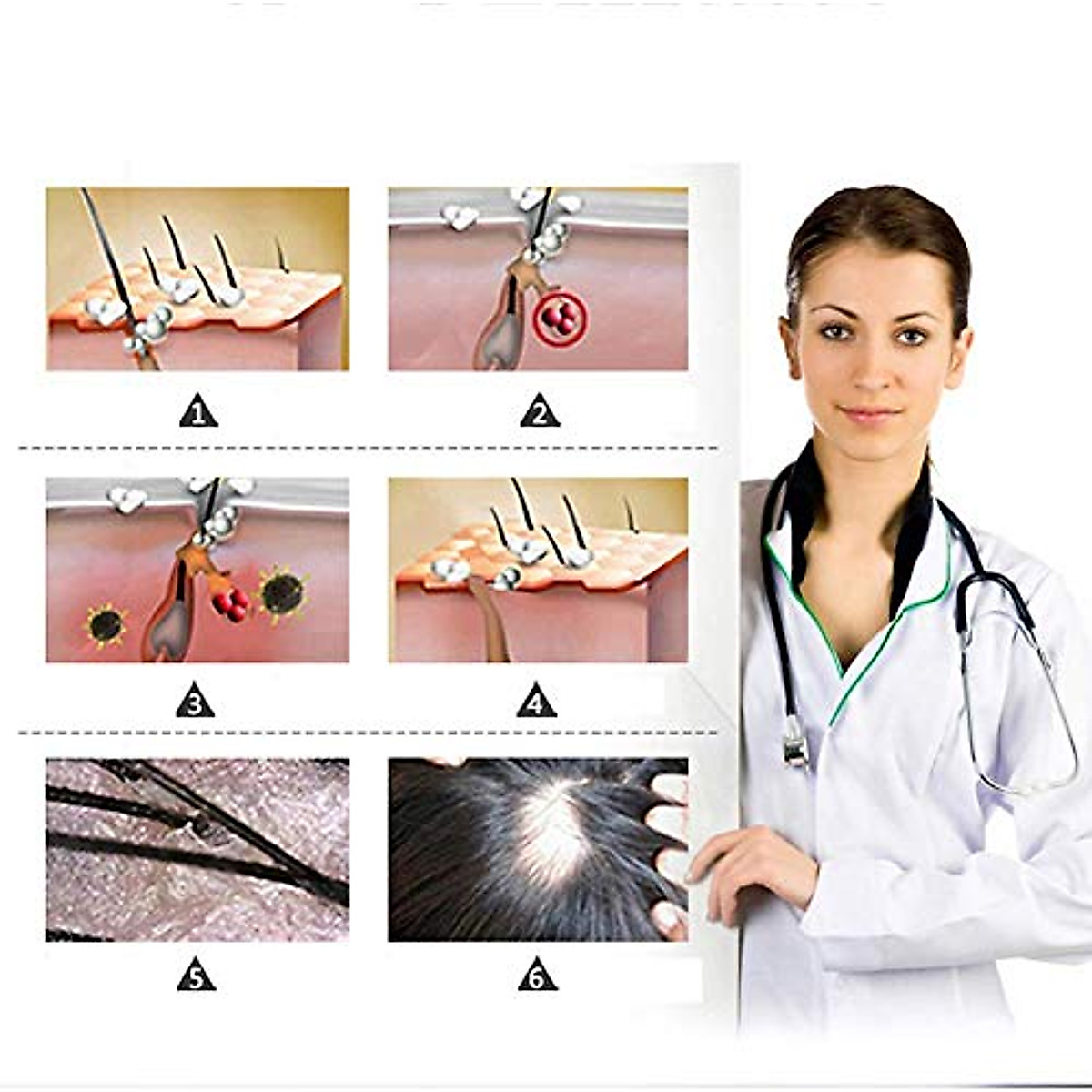 5 PACK Hair Growth Serum Liquid Hair Loss Treatment for Women & Men Dense Thicken Hair