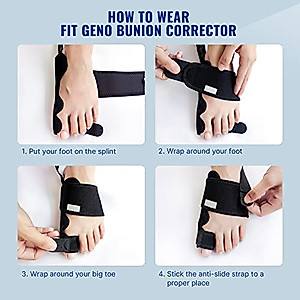 Fitgeno Bunion Corrector Women & Men Big Toe: Foot Straightener Splint Brace - Adjustable Bunyan Correction Orthopedic for Hallux Valgus Pain Relief 2 Pcs