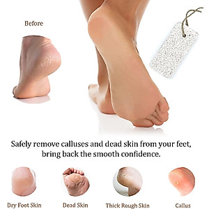 Natural Pumice Stone White for Feet Heels and Palm Set of 2- Pedicure Exfoliation Tool- Hard Callus Remover Health Foot Care Hypoallergenic Best Exfoliation- Corn Remover Dry Dead Skin from Pamukkale