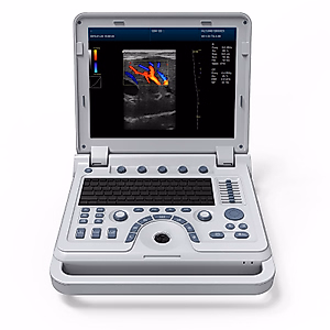 CONTEC Veterinary Ultrasound Scanner Color Doppler for Pregnancy in Animals/Goats/mare/Horses with 7.5Mhz endo-Rectal Probe