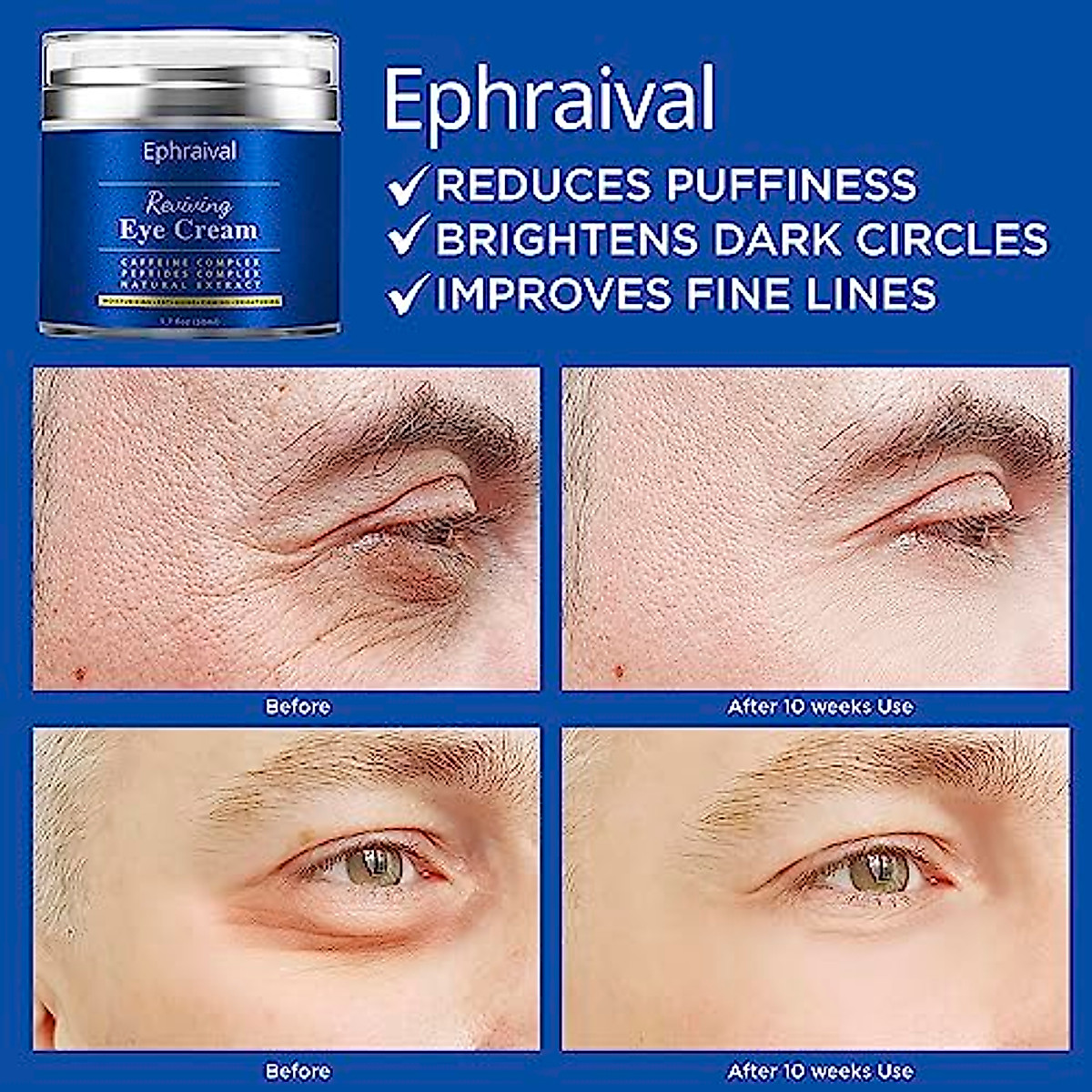 Ephraival Men's Eye Cream, Eye Cream for Dark Circles and Puffiness, Anti-aging Caffeine Eye Cream for Men, Brightens, Reduces Puffiness, Dark Circles, and Fine Lines, Eye Treatment for Men Women