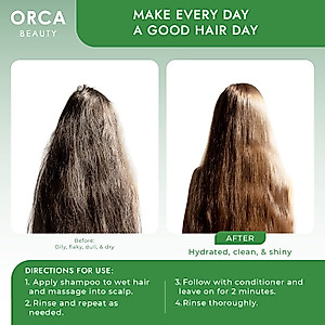 Tea Tree Oil Shampoo and Conditioner Set for Oily Hair, Dry Scalp & Dandruff - 2x16oz for Men & Women