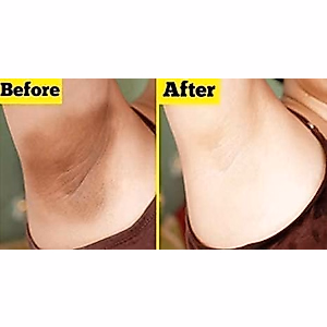 ZWSP Armpit Whitening Cream Skin Lightening Bleaching Cream For Underarm Dark Skin Legs Knees Whitening Intimate Body Lotion