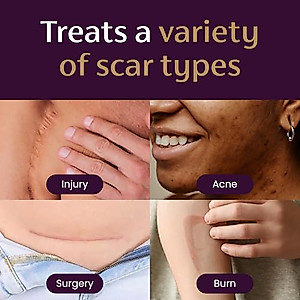 Mederma Scar Cream Plus SPF 30, Sunscreen, Protects from Sun Damage, Reduces the Appearance of Scars