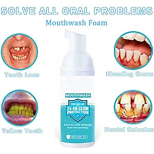 2 Bottle Mouthwash, Calculus Removal, Healing Mouth Ulcers, Eliminating Bad Breath, Prevents and Treats Cavities,Natural Tooth Whitening Foam,Tooth Regeneration