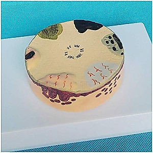 Anatomy Model Human Skin - Skin Enlarged Anatomy Model - Medical Anatomical Skin Structure Model Medical Teaching Model - for Medical Educational Aid