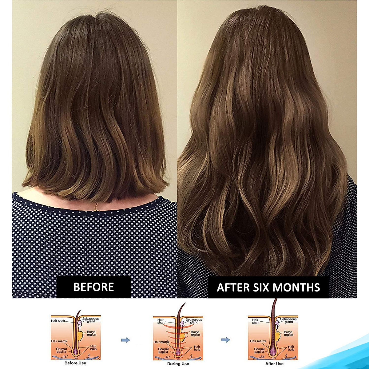 Hairgenics Pronexa Clinical Strength Hair Growth & Regrowth Therapy Hair Loss Shampoo With Biotin, Collagen, and DHT Blockers for Thinning Hair, 8 fl. oz.