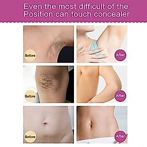 Dark Spot Cream, Natural Underarm Cream, Dark Spot Cream Corrector for Neck and Dark Spots, Sun Spots, Age Spots, Hyperpigmentation, Even Sensitive Skin-Instant Result