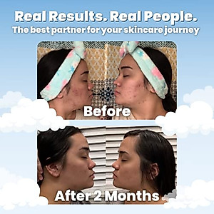 Clean Skin Club Clean Towels, 100% Biobased Dermatologist Face Towel, Disposable Face Towelette, Facial Washcloth, Makeup Remover Dry Wipes, Ultra Soft, 25 count, 1 pack