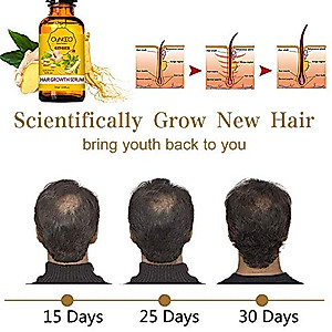 5 PACK Hair Growth Serum Liquid Hair Loss Treatment for Women & Men Dense Thicken Hair