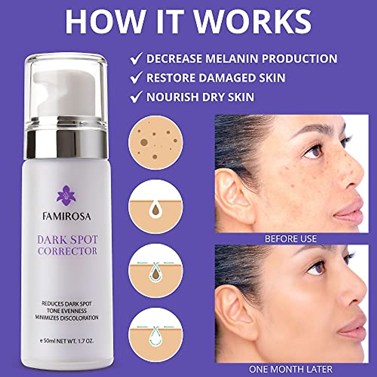 Dark Spot Remover for Face - Dark Spot Corrector Serum for Sun Spot Brown Spots Stubborn Spots-Freckle Remover - Melasma Hyperpigmentation Treatment Formulated with 4-Butylresorcinol, Kojic Acid and Hyaluronic acid- 50 ml
