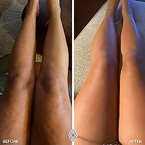 The Blaster Oil and After Blaster Cream by Ashley Black. Use with FasciaBlasting for Maximum Results. Blaster Fat Burning Oil and Soothing Arnica and Skin Tighteners for Post FasciaBlast