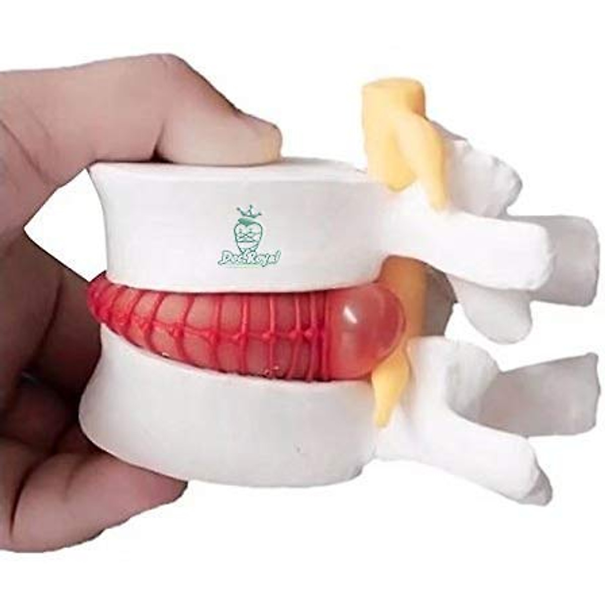 Doc.Royal Anatomical Human Lumbar Vertebrae Degenerative Lumbar Human Spine Model 1PCS