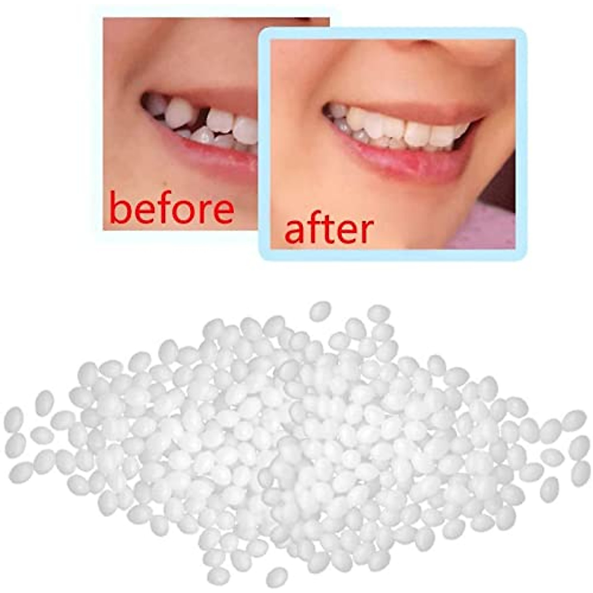 Decorative Denture Cup with For And Solid Tooth Make Glue Denture Teeth (30g) FalseTeeth Temporary Adhesive Confidently Tooth Missing Teeth Gaps Kit Denture Clip on Braces for Looks