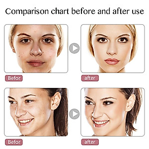 Meifuly Light Therapy Face Mask, 7 Colors L E D Facial Face Mâsk