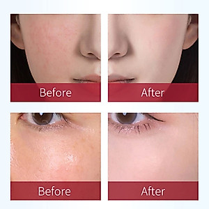 Rosaderm Fast Gel Cream, Corrective And Treatment Of Flushing, Skin Tint Corrective Anti Redness Soothing Calming Hydro Primer Silky Moist Delicate Isolating Pore Eraser Light Weight Primer, 30g