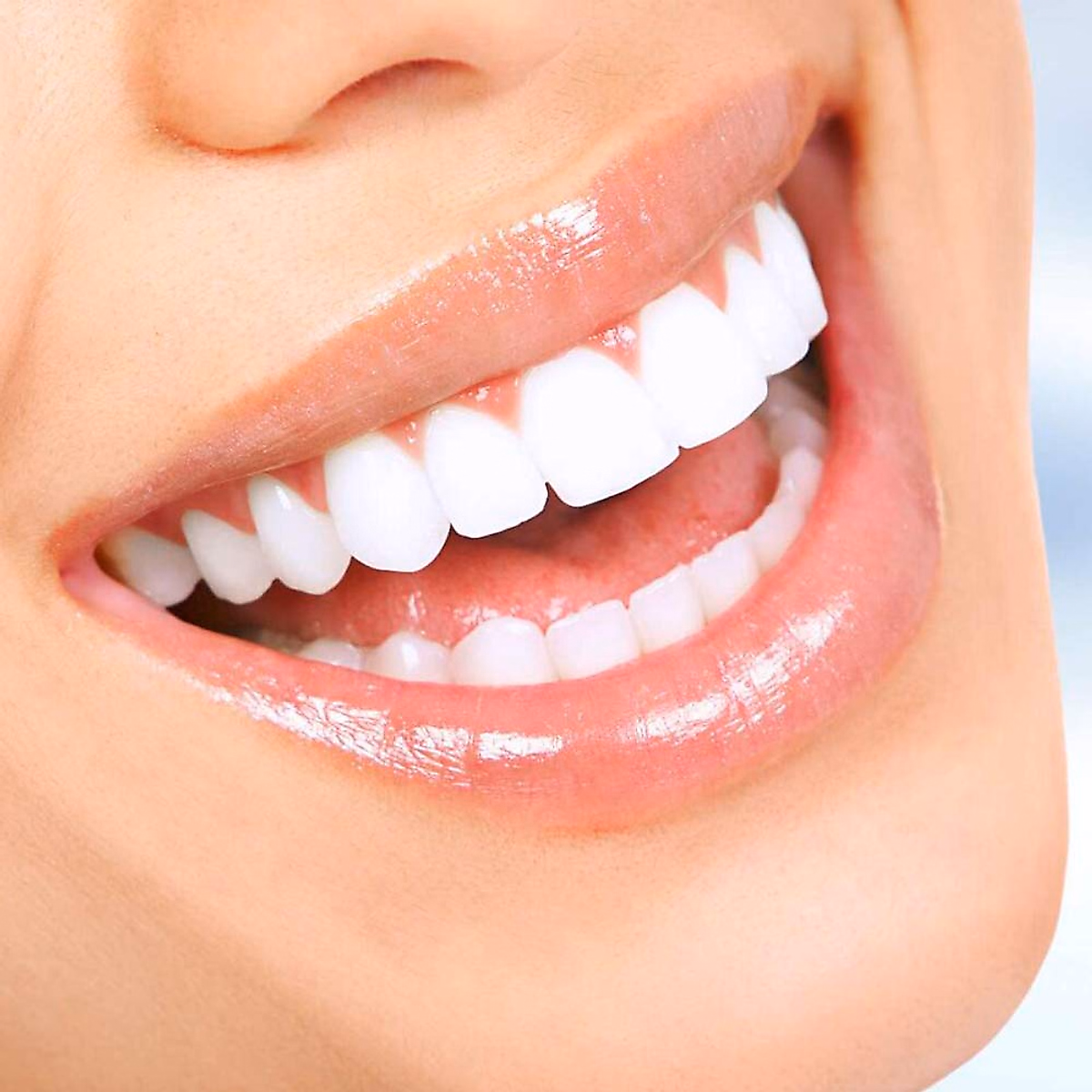 WuYan 4 Pack Toothbrush Heads for Xiaomi Deep Cleaning, Automatic Electric Sonic Replacement Tooth Brush for Soocare X3 Electric toothbrushes, with Travel Caps