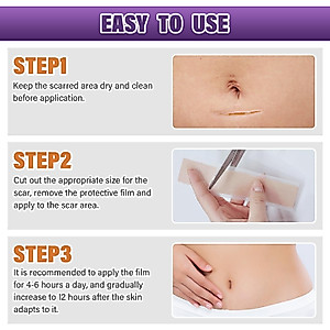 Silicone Scar Sheets,Silicone Scar Tape,Scar Tape For Surgical Scars,Silicone Scar Removal Strips For Surgical,C-Section,Tummy Tuck,Keloid Scars(1.6"X 59" Roll-1.5M) Keloid Bump Removal