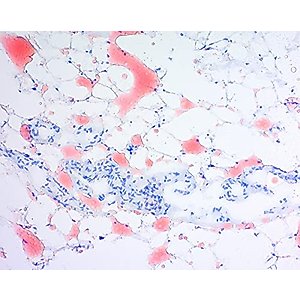 Oil Red O Stain Pack (for Fat), 125ml