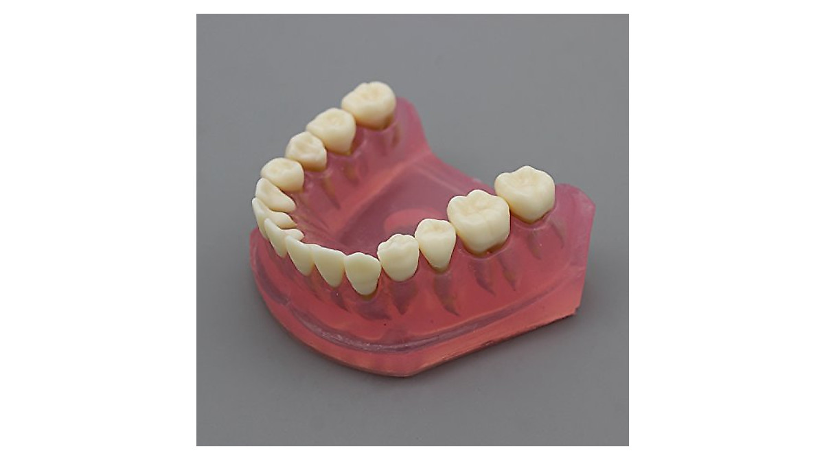 Dental Implant Model for Training and Teaching