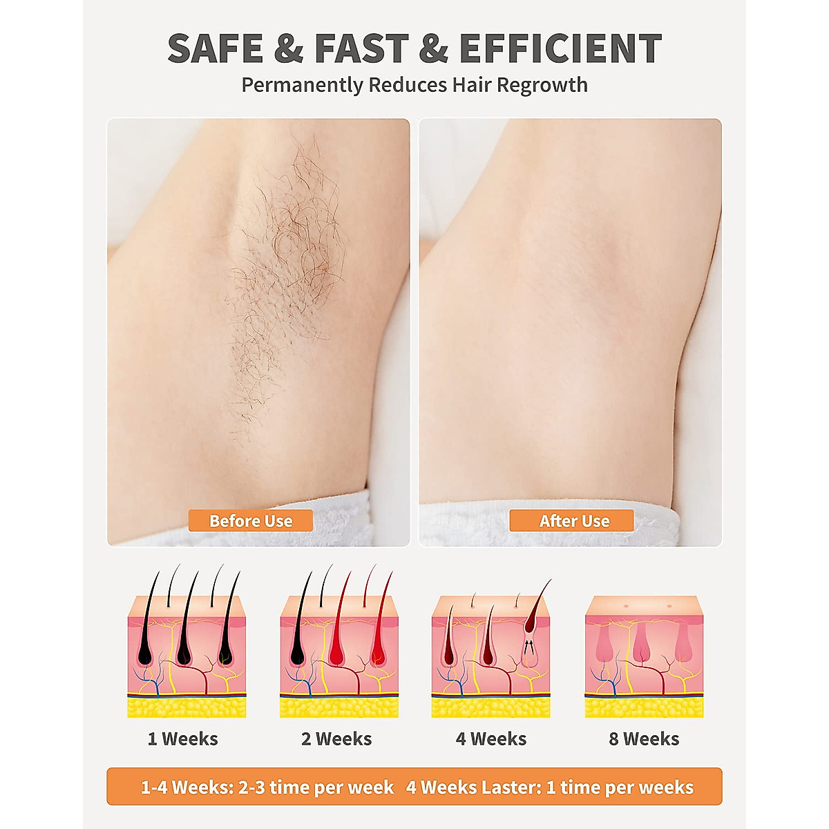 GERCY Hair Removal Device, Laser Hair Removal for Women Permanent with 9 Energy Levels, 2 Flash Modes and 999,999 Flashes, IPL Hair Removal for Face, Arms, Armpits, Bikini Line, Legs and Whole Body