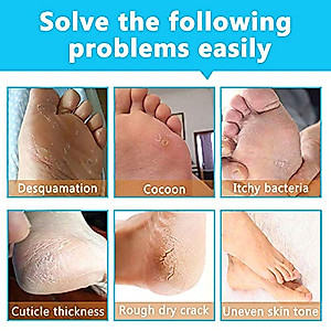 Foot Peel Mask-3 Pack,Foot Exfoliating Set With Milk Serum,Baby Foot Peeling-Cracked Feet Treatment,Dead Skin Heel Scraper For Feet,Disposabel Feet Spa Socks,Intensly Moisturizes Repair and Softens The Feet