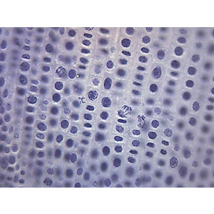 10pk Onion Mitosis, Prepared Microscope Slides - 75 x 25mm - Classroom Pack, 10 Slides in Storage Case - Plant Mitosis, Introductory Microscopy - Eisco Labs
