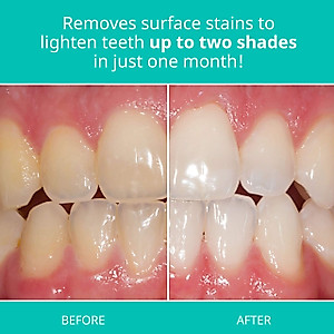 Opalescence Whitening Toothpaste for Sensitive Teeth - Oral Care, Mint Flavor, Gluten Free - 3 Pack